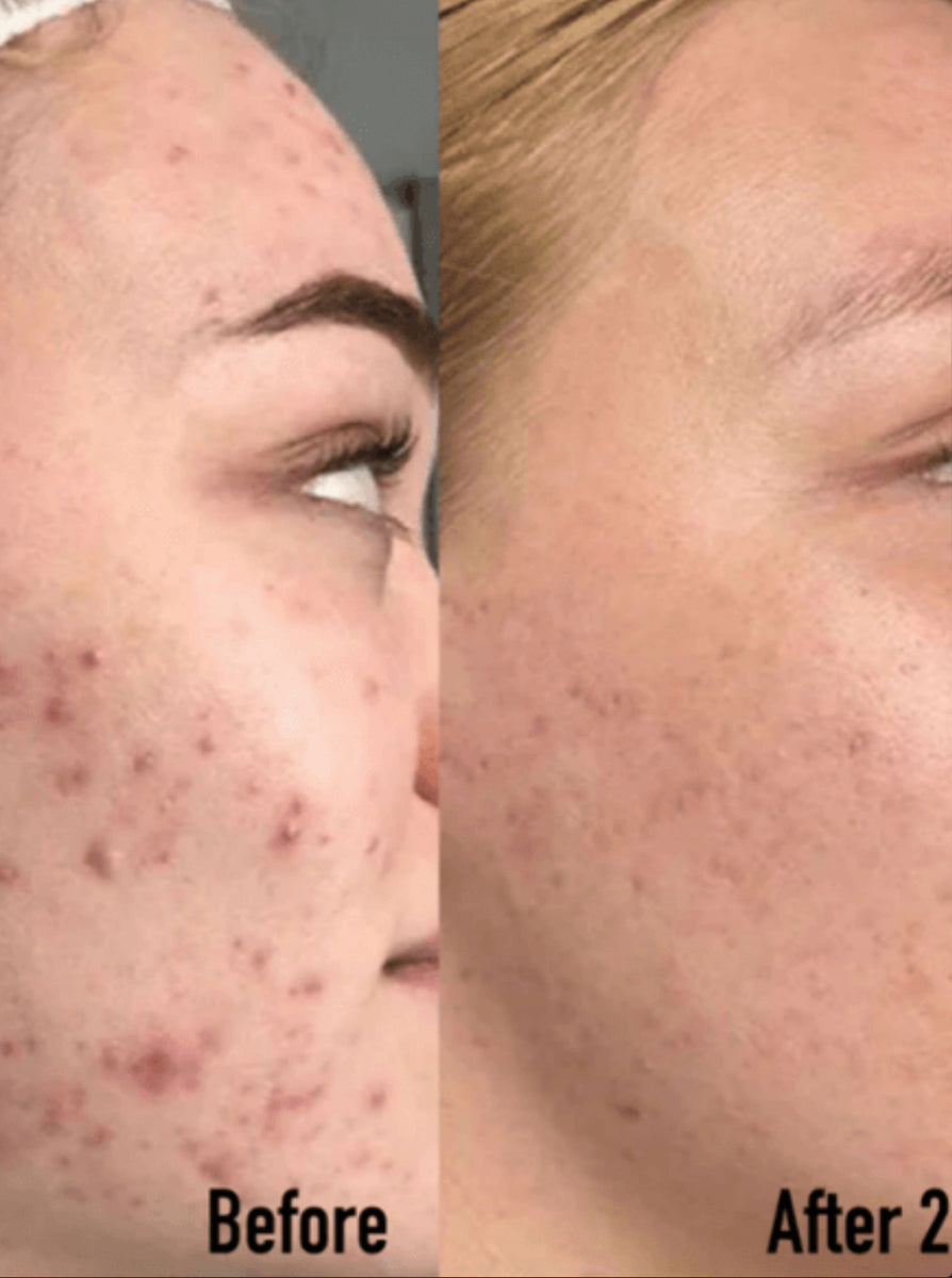 LUXE CLINICAL - RED LIGHT FACIAL MASK – HMD Methods